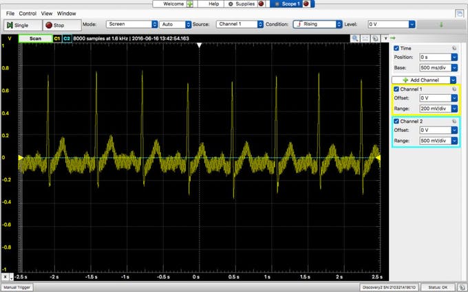 DIY ECG Using an Analog Discovery 2 and LabVIEW – Digilent Blog